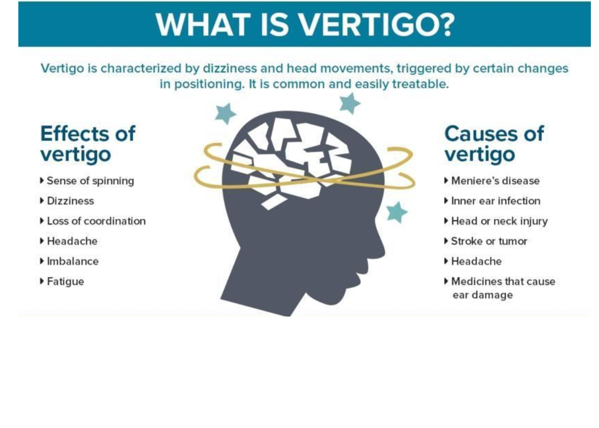 VertiSensations - Vertigo | #Vertigo #Migraine headaches #Meniere's ...
